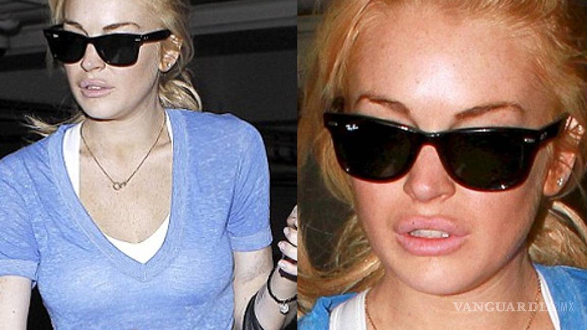 ¿Qué le pasó en el rostro a Lindsay Lohan?