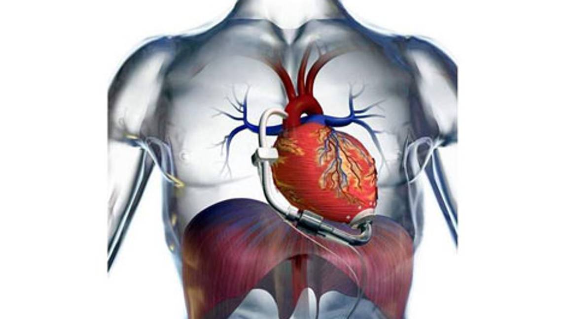 Crean marcapasos más pequeño que un grano de arroz