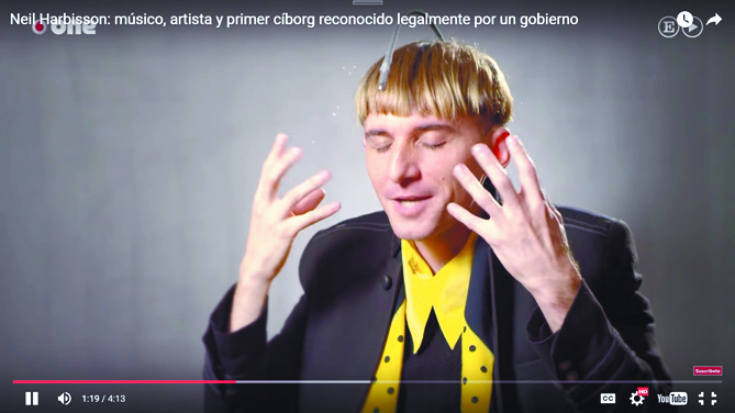 Reconocen a primer cyborg