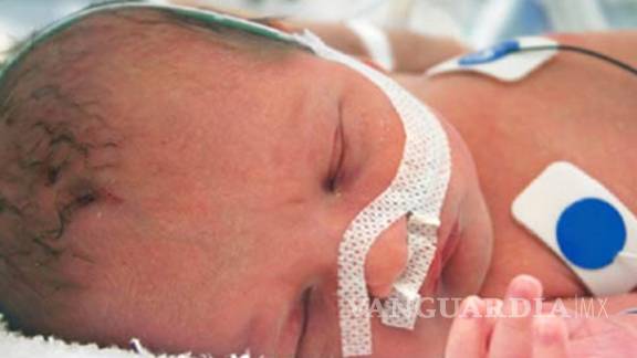 Desarrollo de corteza cerebral en bebés prematuros dictará cognición