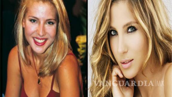 Desnudan a Elsa Pataky antes y después de la cirugía