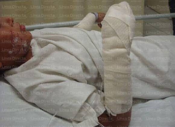 Un niño pierde la mano y un dedo, al explotarle un cohete