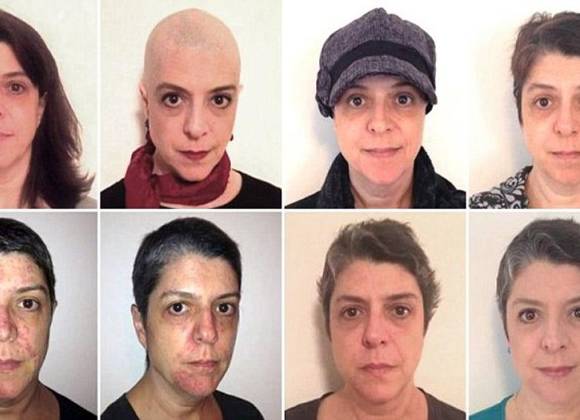 Le ganó al cáncer y comparte las fotos de un año de tratamiento (video)