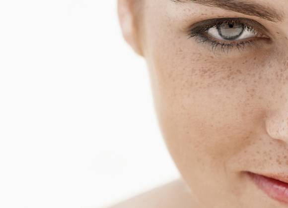 Mujeres con pecas son más atractivas para los hombres