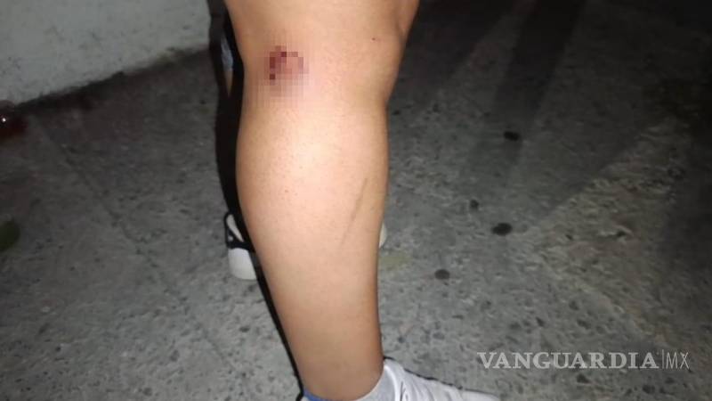 Ataca perro a mujer en Parras; vecinos denuncian reincidencia del animal