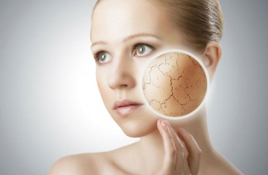 Cuidado con la resequedad en la piel ante bajas temperaturas: SSA